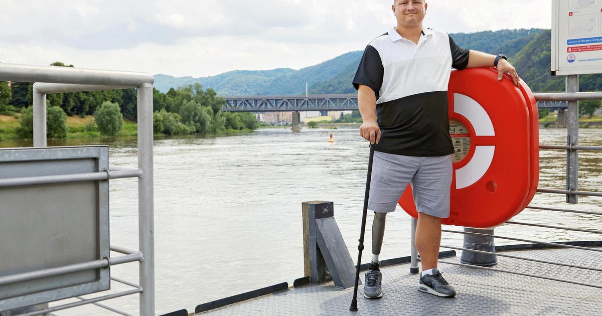 Beinamputation und deren Folgen | Suva