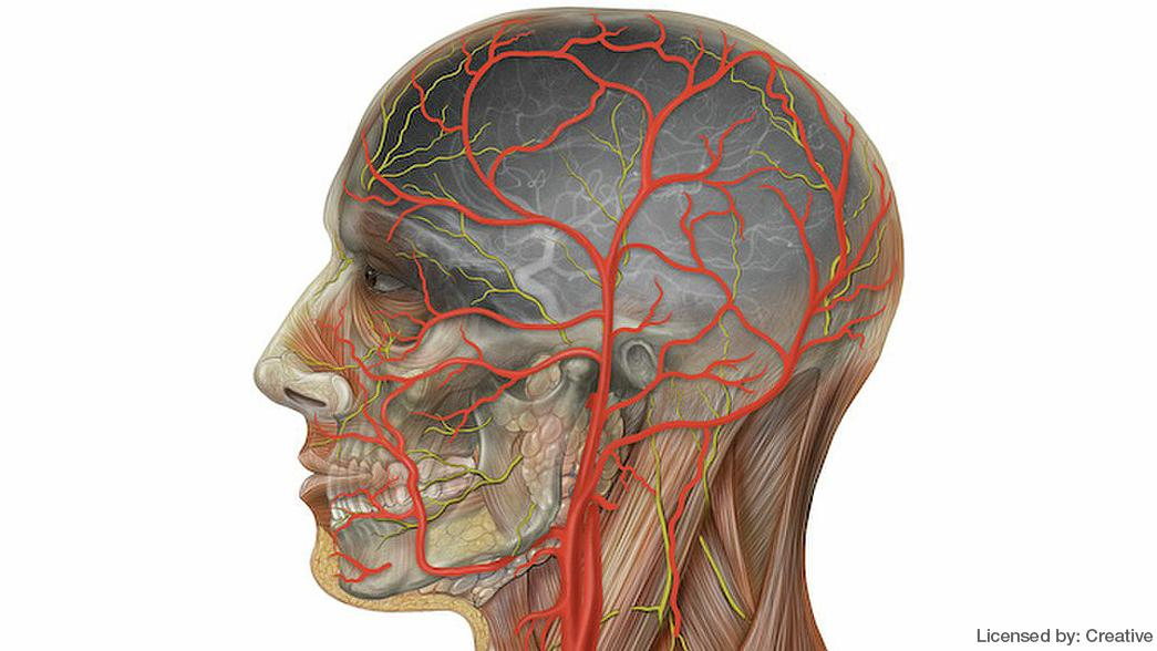 Aspects médico-légaux de la dissection des artères cervicales
