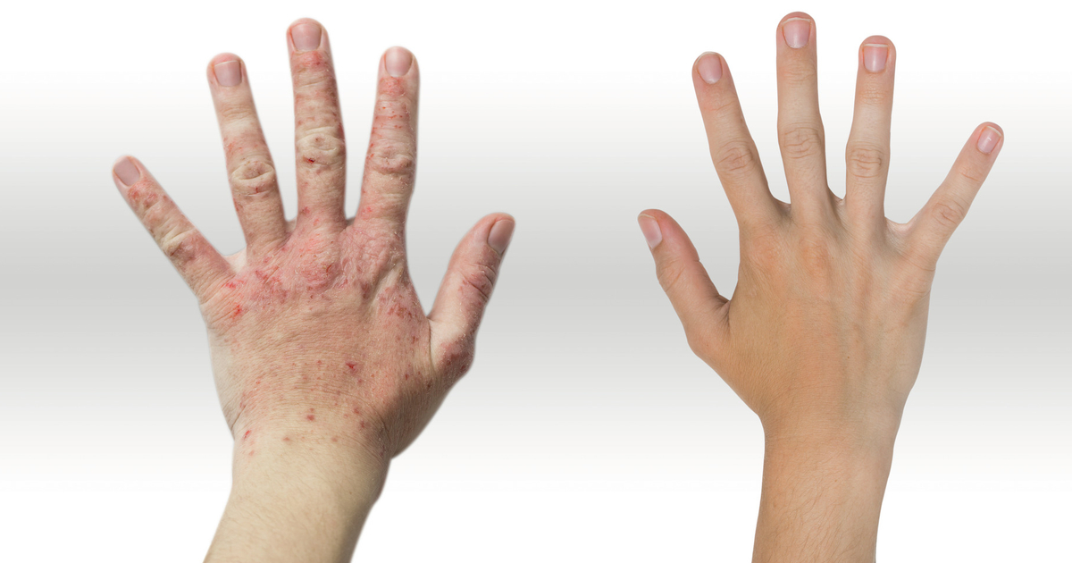 Hautschutz bei der Arbeit, aber richtig | Suva